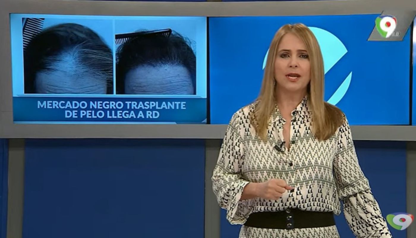 Mercado Negro Trasplante de Pelo llega a RD | Nuria Piera - Color Visión
